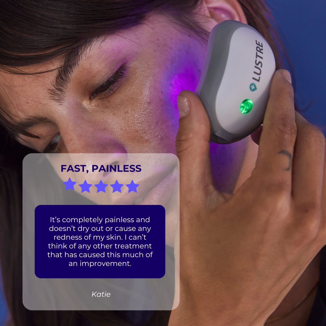 How does Blue Light therapy treat acne? - LUSTRE® ClearSkin